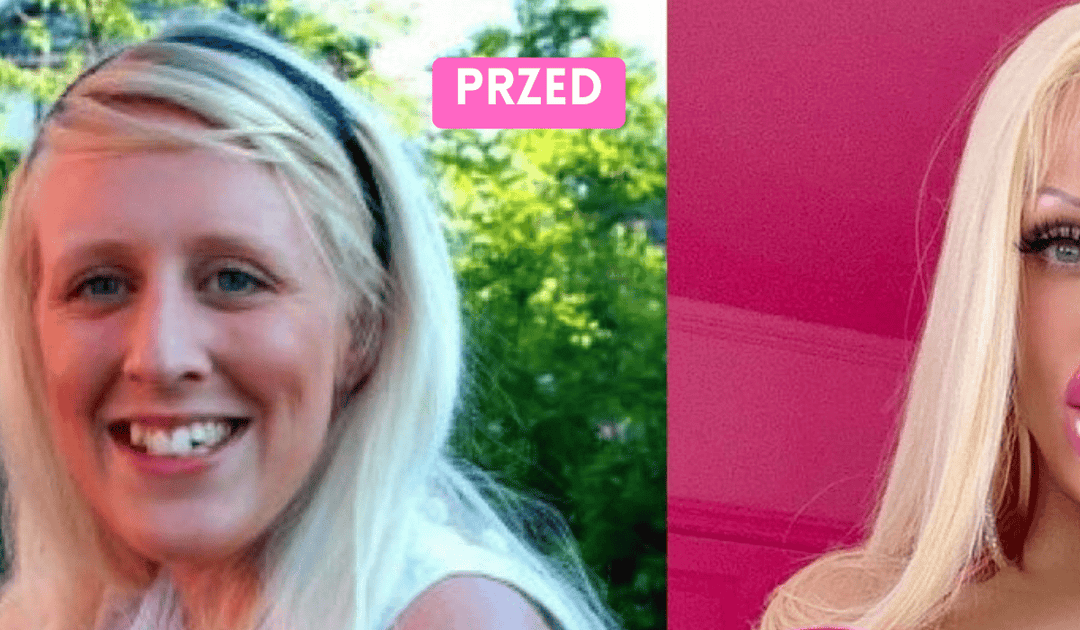 Wydała pół miliona na operacje plastyczne. Teraz wygląda jak żywa lalka ...