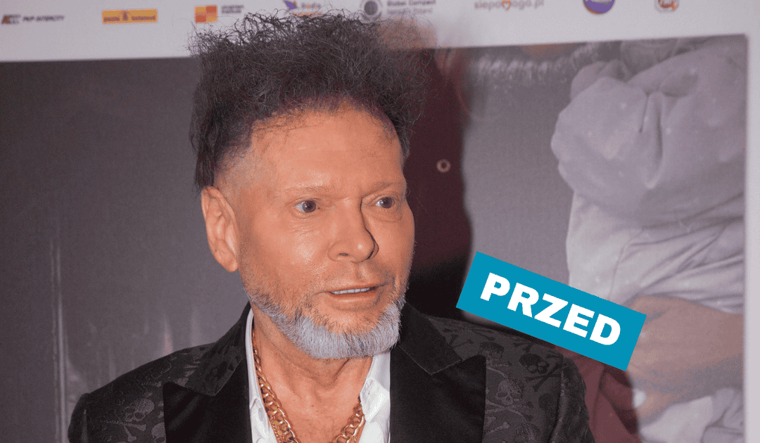 Rutkowski już tak nie wygląda. W ruch poszła farba czarna jak heban