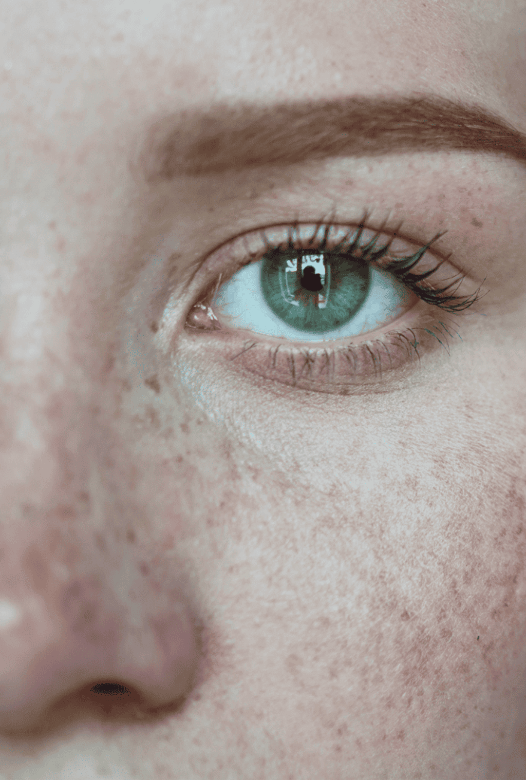 Jak powstają piegi i czy można je usunąć? Oto sprawdzone sposoby na ...