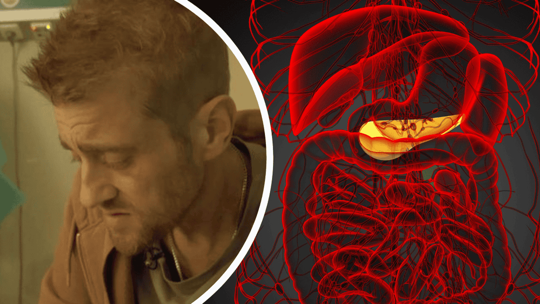7 typowych objawów raka dwunastnicy. To na niego choruje Tomasz Jakubiak