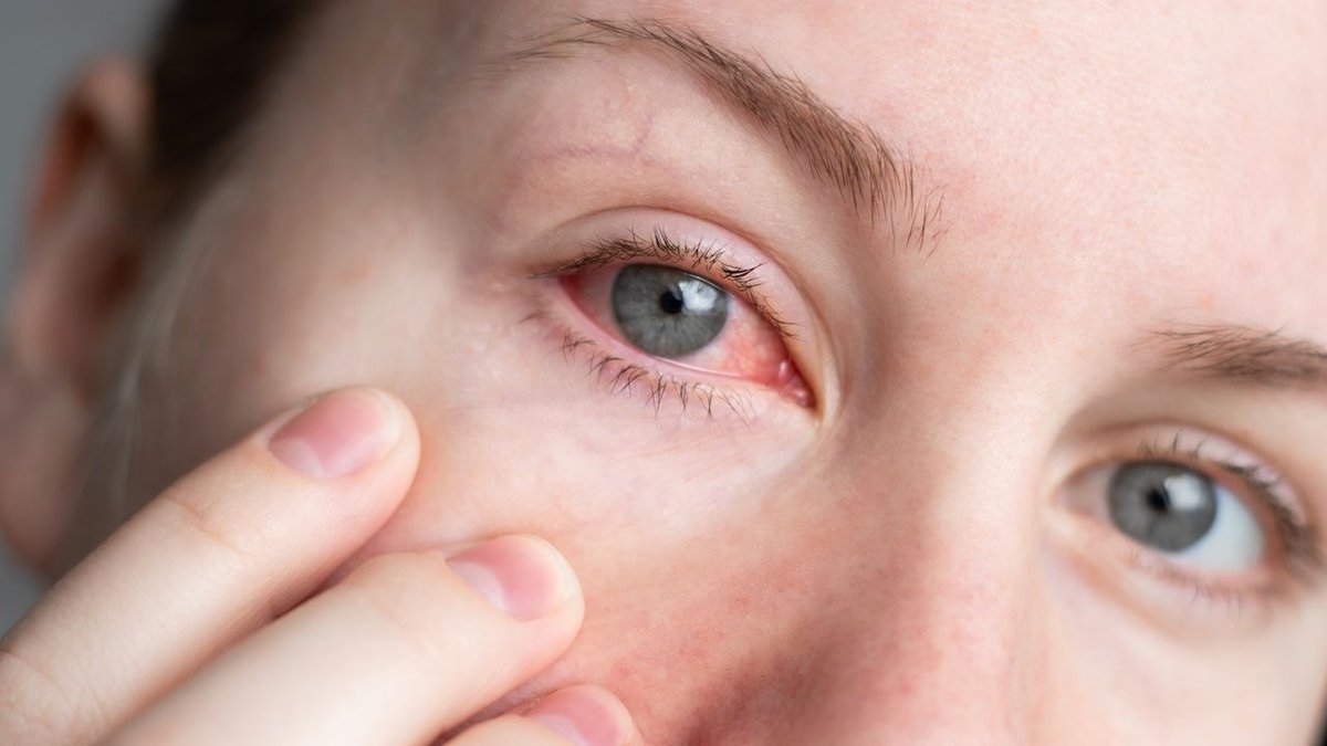 Czyrak - rozpoznanie, objawy, leczenie. Kiedy czyrak jest niebezpieczny?