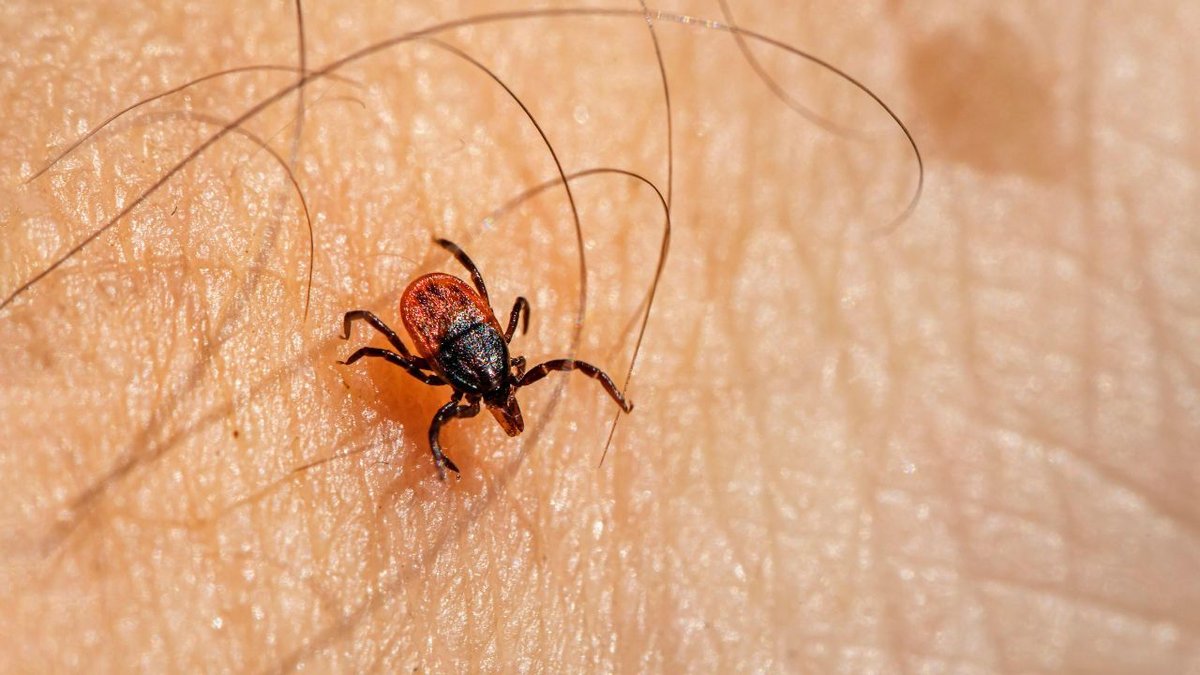 Czyrak - rozpoznanie, objawy, leczenie. Kiedy czyrak jest niebezpieczny?