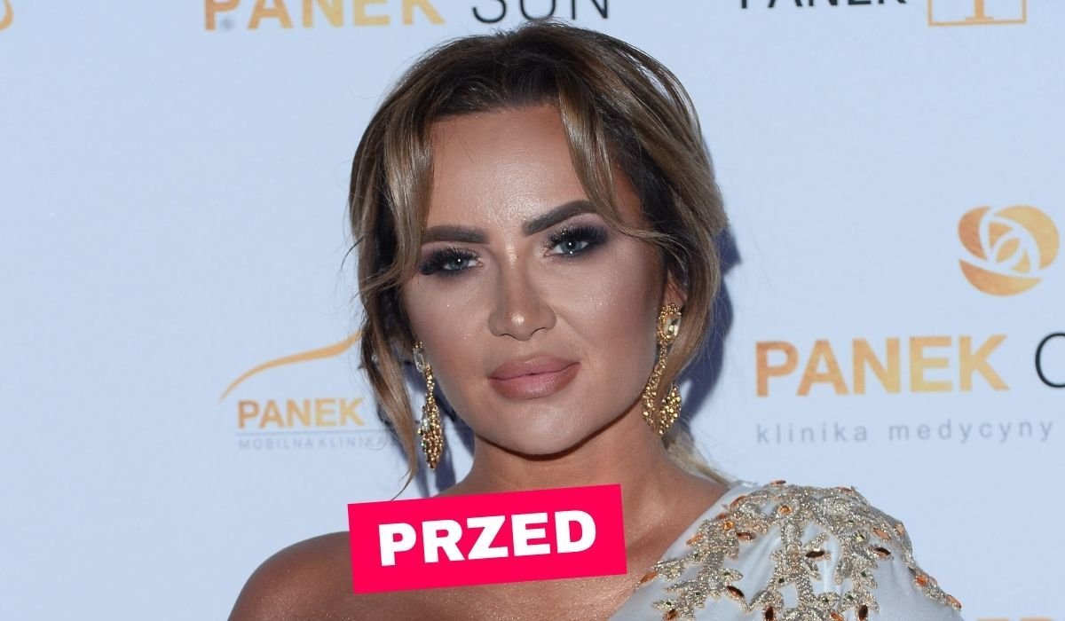 Izabela Macudzińska ma nową twarz, poddała się operacji w Turcji. Teraz ...