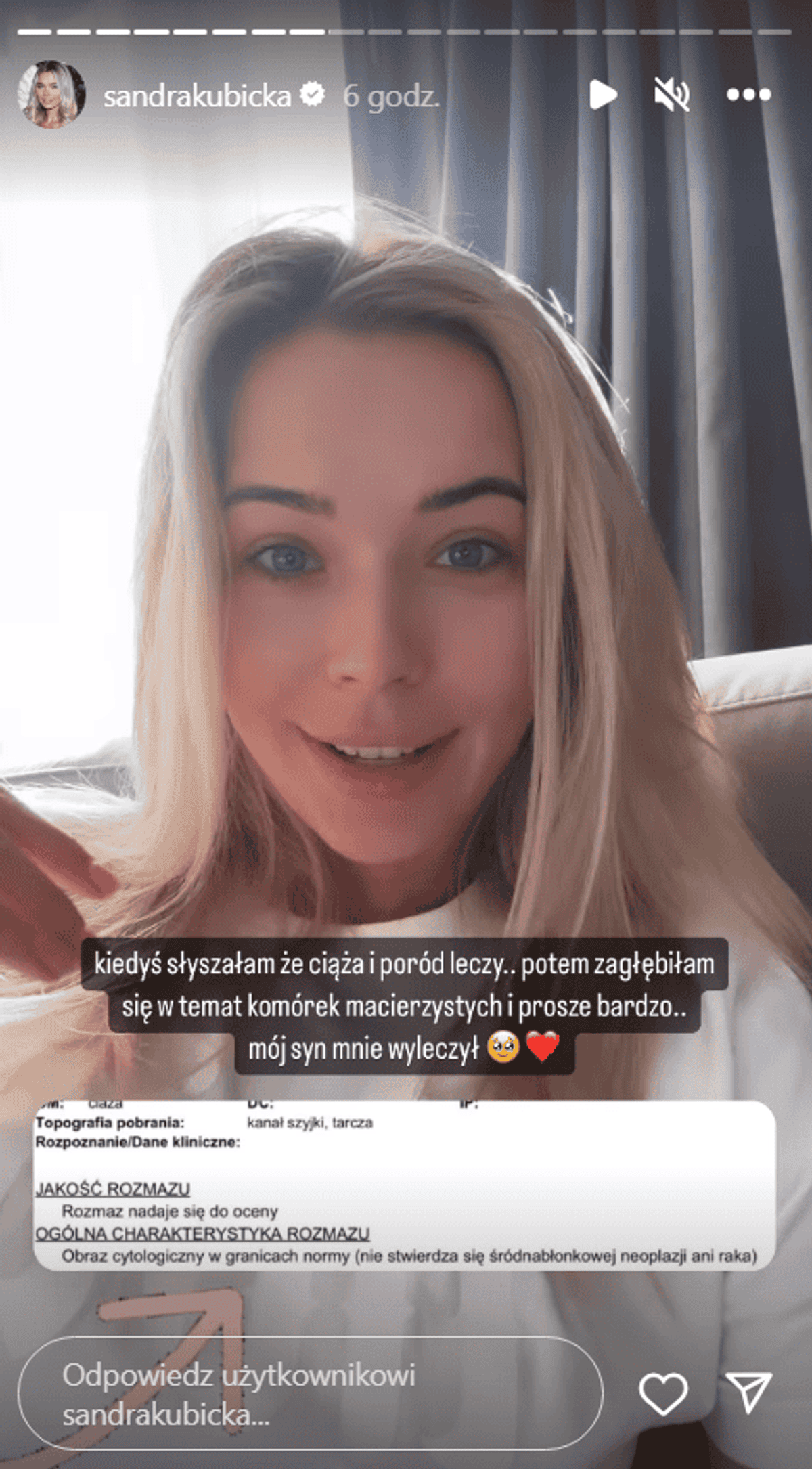 Sandra Kubicka: zmiany nowotworowe, ciąża, co się dzieje? | Świat Gwiazd