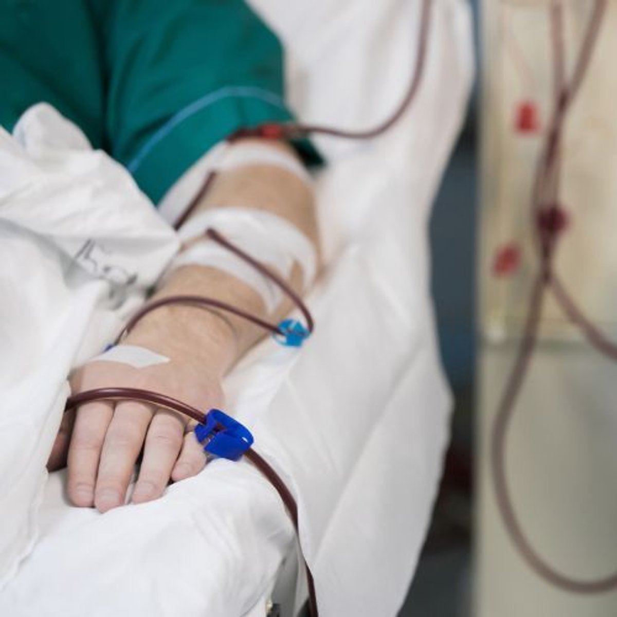 Chore nerki zwykle nie bolą. Jak o nie zadbać? | Pacjenci