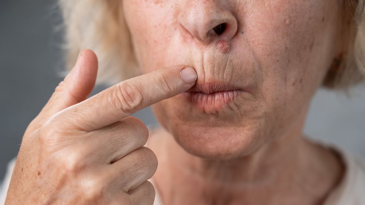 Leki SSRI – skutki uboczne, przeciwskazania, bezpieczeństwo