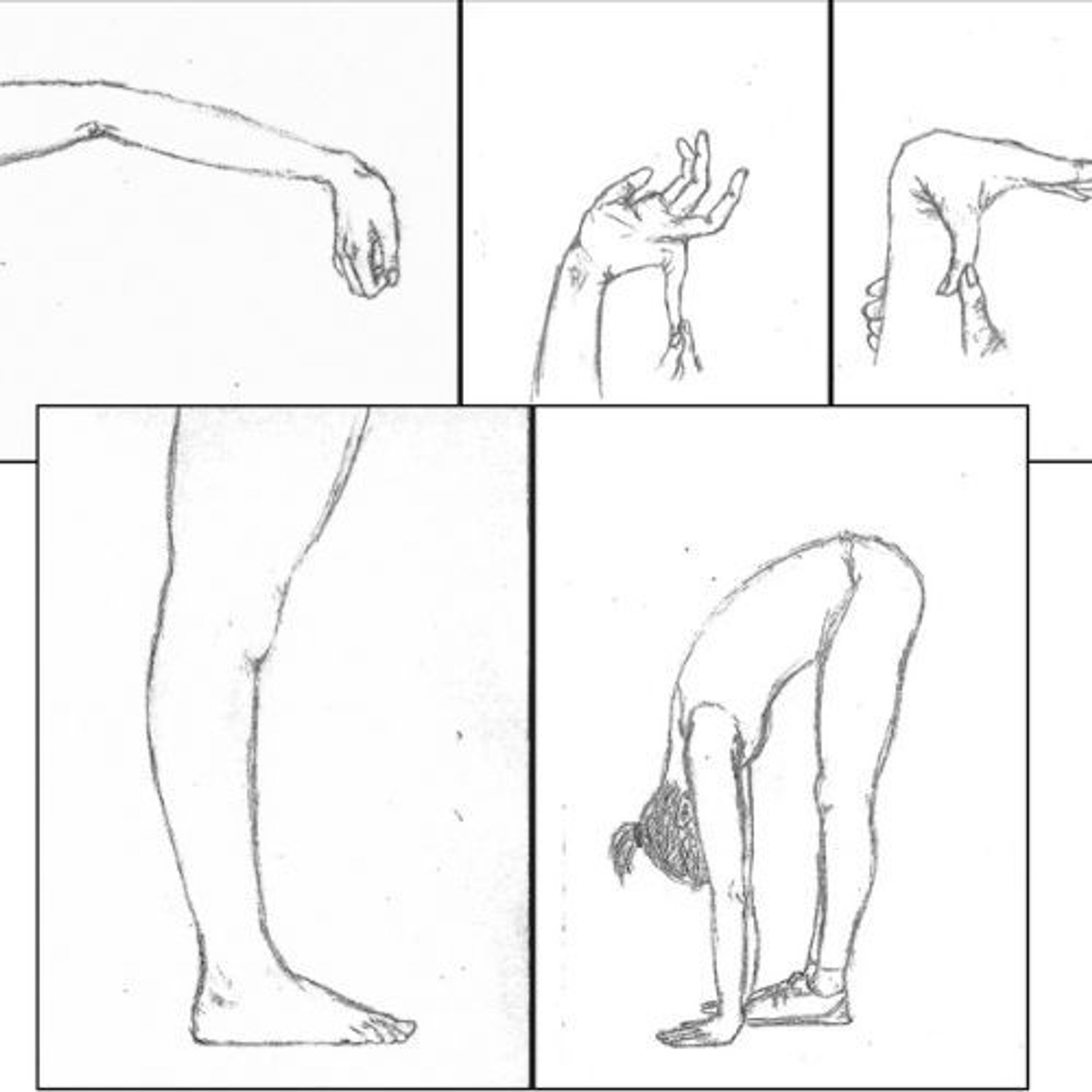 Zespół Ehlersa-Danlosa – przyczyny, objawy, leczenie | Pacjenci