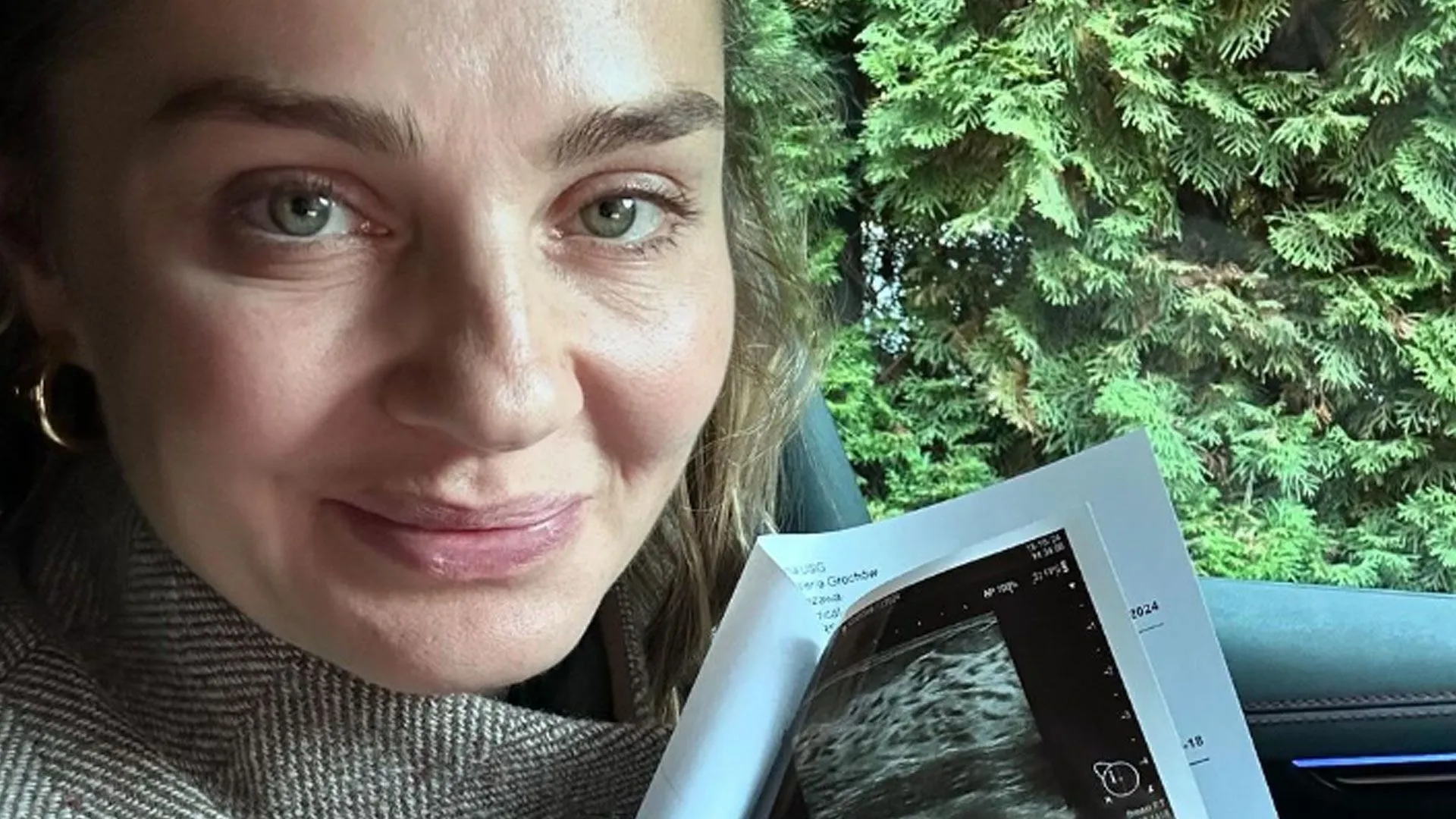 Małgorzata Socha - wiadomości tematyczne | Świat Gwiazd