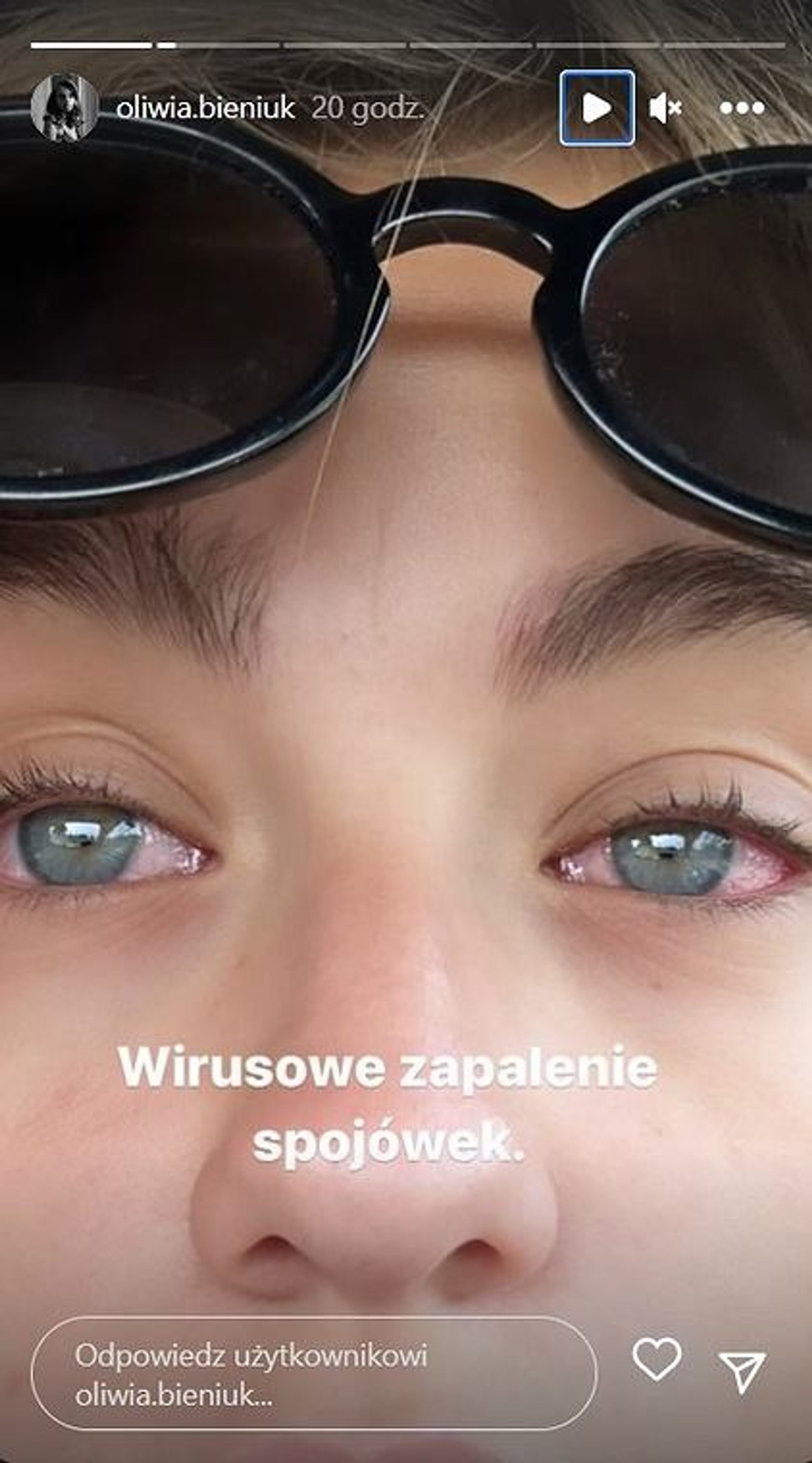 Oliwia Bieniuk jest chora. Co się dzieje? | Świat Gwiazd